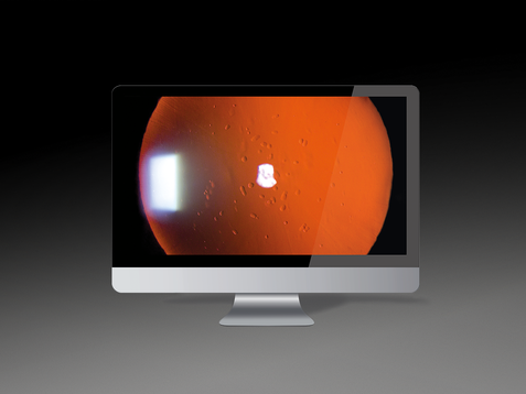 Imaging Module 910 IM910